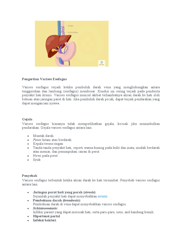Varises Esofagus | PDF