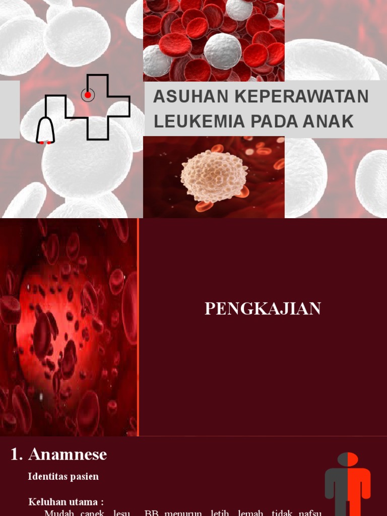 Askep Leukemia Pada Anak | PDF | Kesehatan Holistik | Sains & Matematika