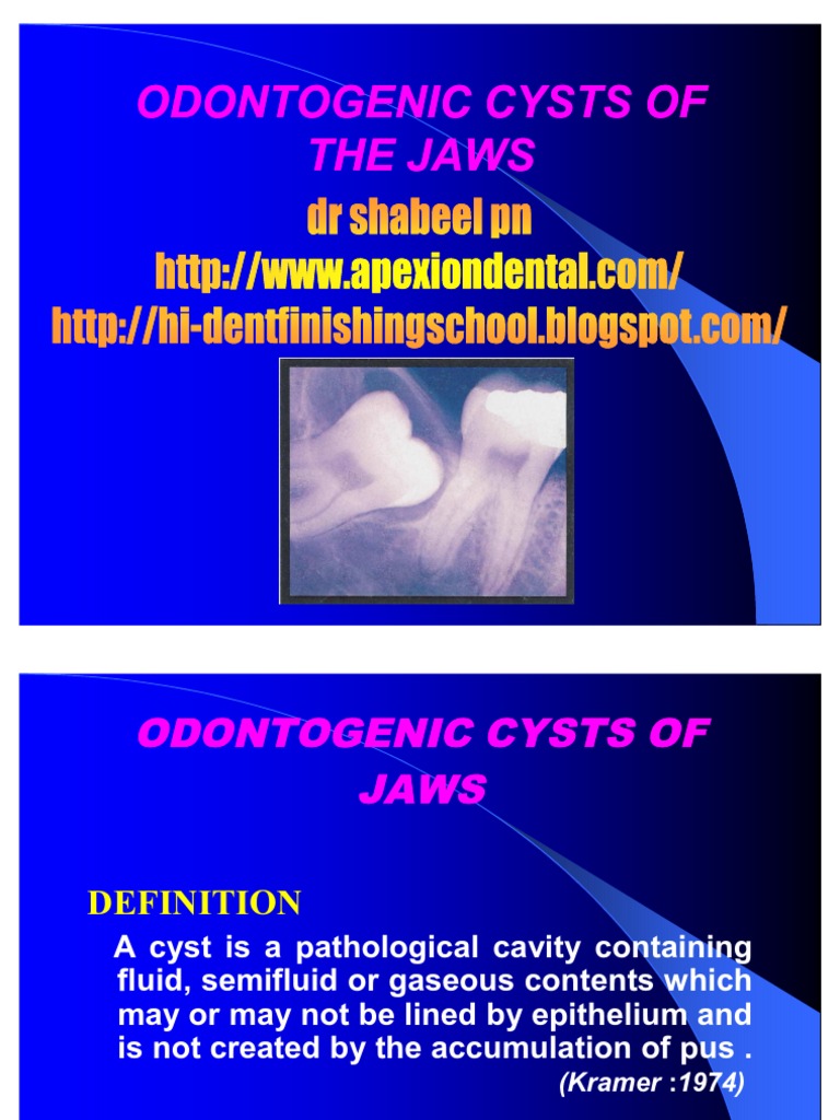 Odontogenic Cysts Overview | PDF | Epithelium | Periodontology
