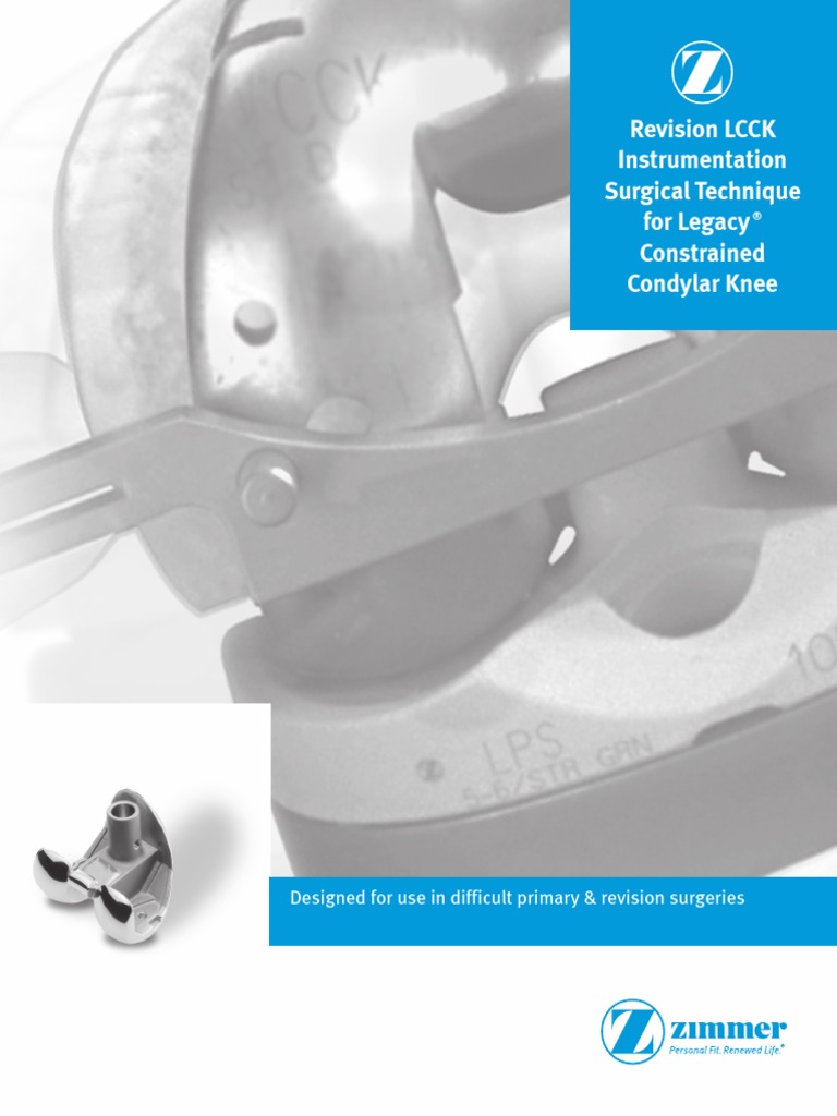 Revision LCCK Instrumentation Surgical Technique | PDF | Knee | Limbs ...