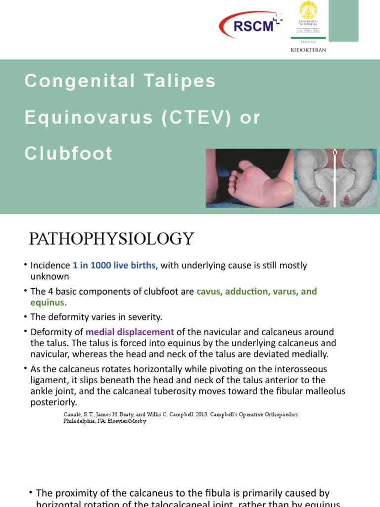 CTEV | PDF | Foot | Anatomical Terms Of Motion