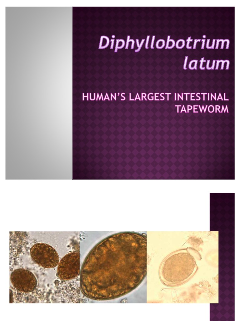 Diphyllobothrium Latum | PDF