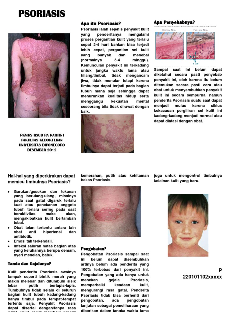 Leaflet Psoriasis | PDF