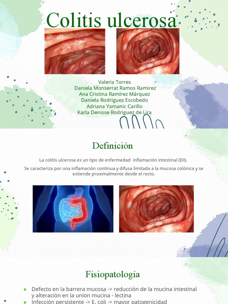 Colitis Ulcerosa | PDF | Cáncer colonrectal | Sistema inmune