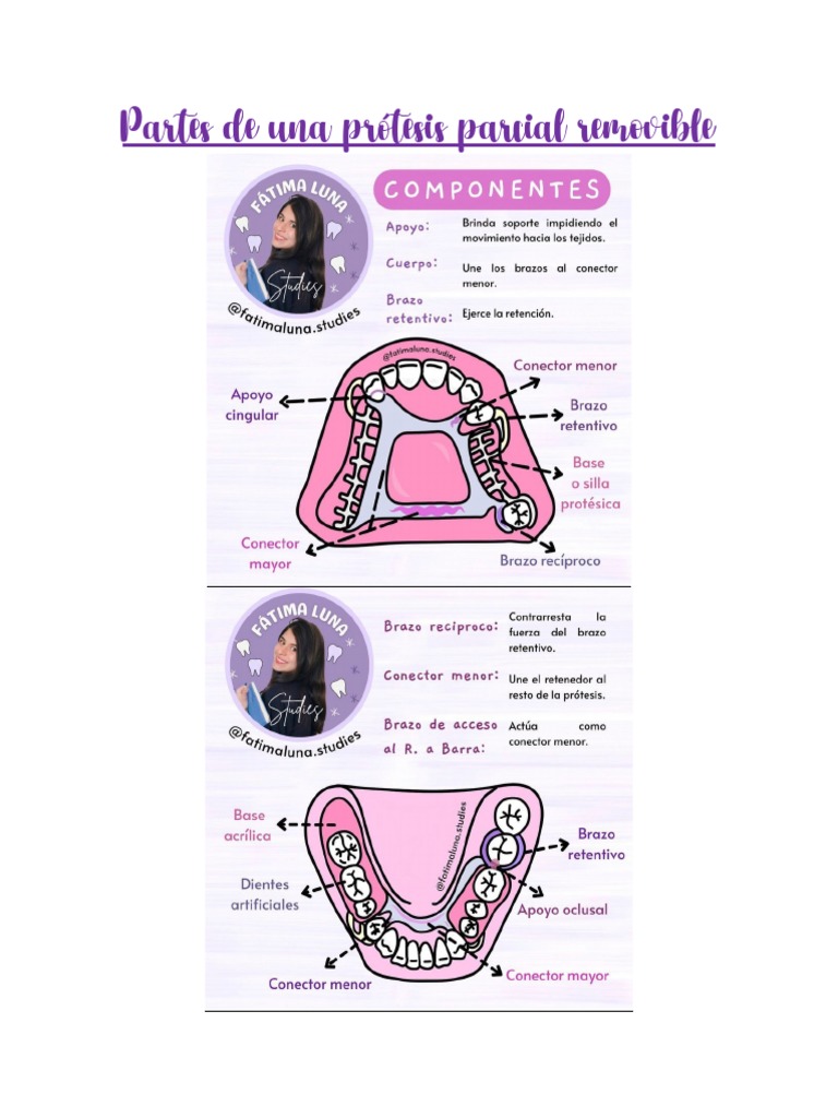 Partes de Un PPR | PDF