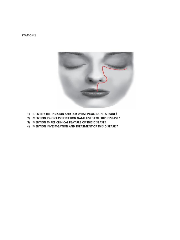 Ent Osce | PDF | Medical Diagnosis | Human Diseases And Disorders