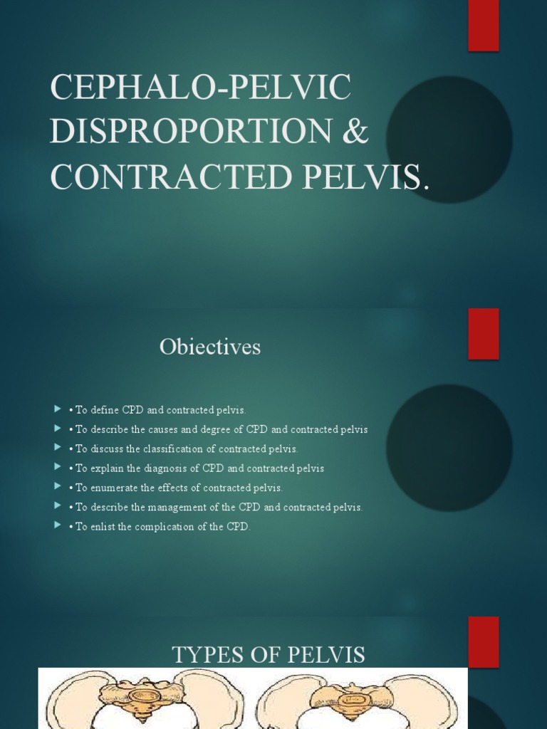 Pephalo Pelvicdisproportion &contracted Pelvis | PDF | Childbirth | Pelvis