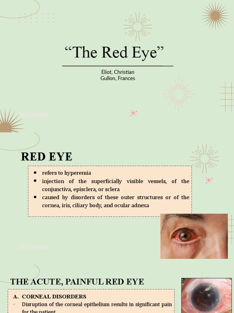 The Red Eye | PDF | Cornea | Medicine