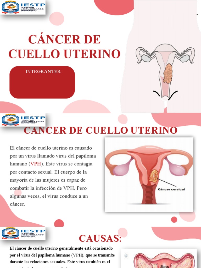 Cancer de Cuello Uterino | PDF | Cáncer de cuello uterino | Cáncer