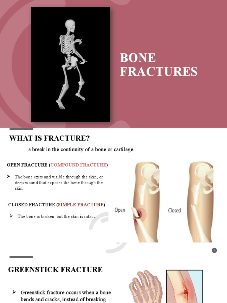 Bone Fractures | PDF | Bone | Osteoblast