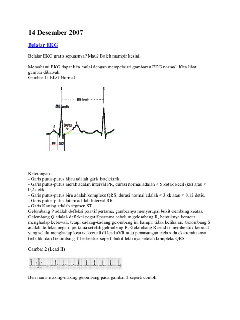 Belajar Ekg | PDF
