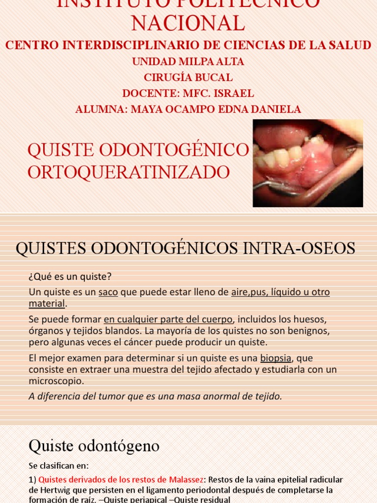 Quiste Odontogénico Ortoqueratinizado | PDF | Epitelio | Medicina CLINICA