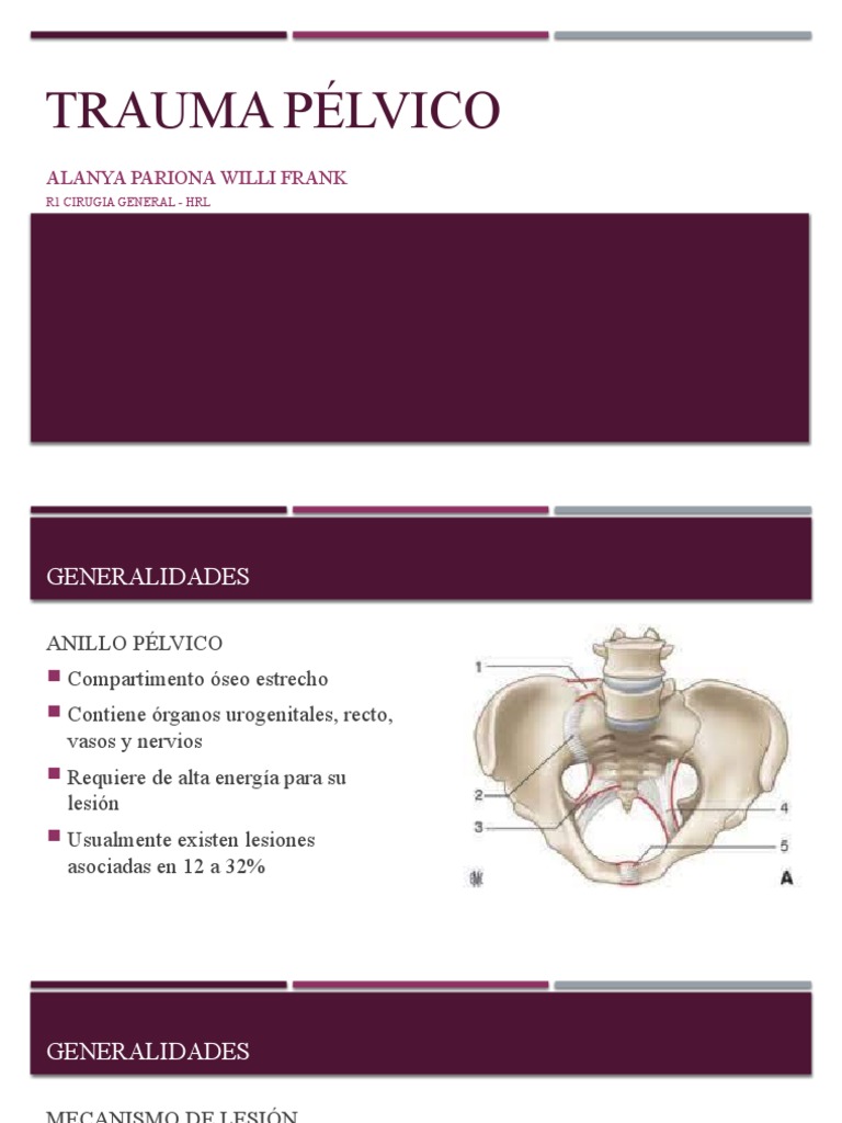 TRAUMA PÉLVICO - Expo | PDF | Pelvis | Vejiga urinaria