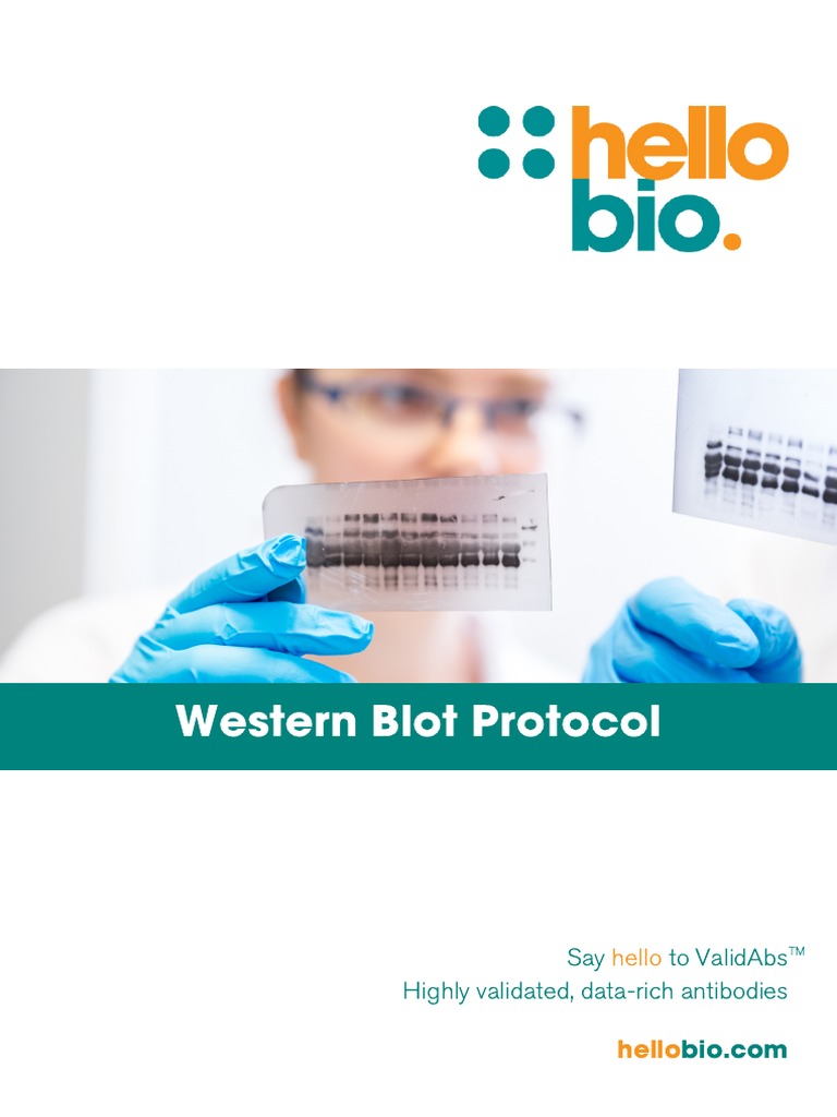 Western Blot Protocol | PDF | Western Blot | Gel Electrophoresis