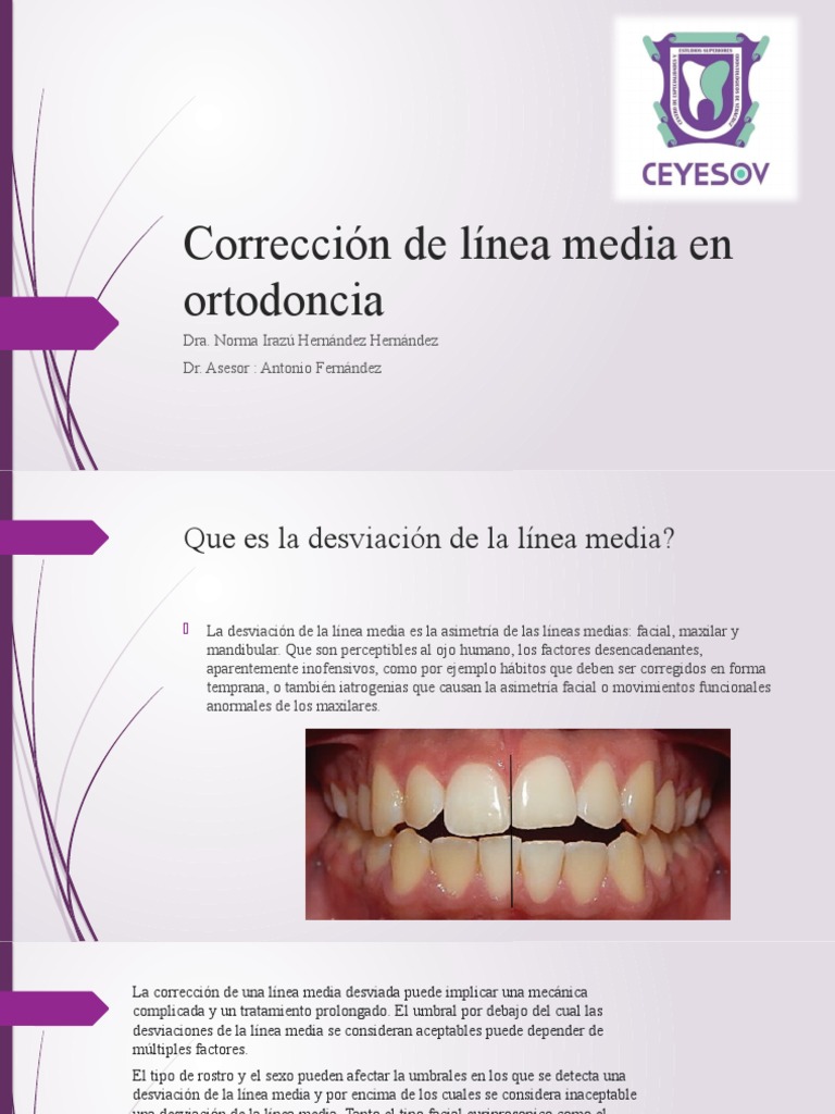 Corrección de Línea Media en Ortodoncia | PDF | Ortodoncia | Cara
