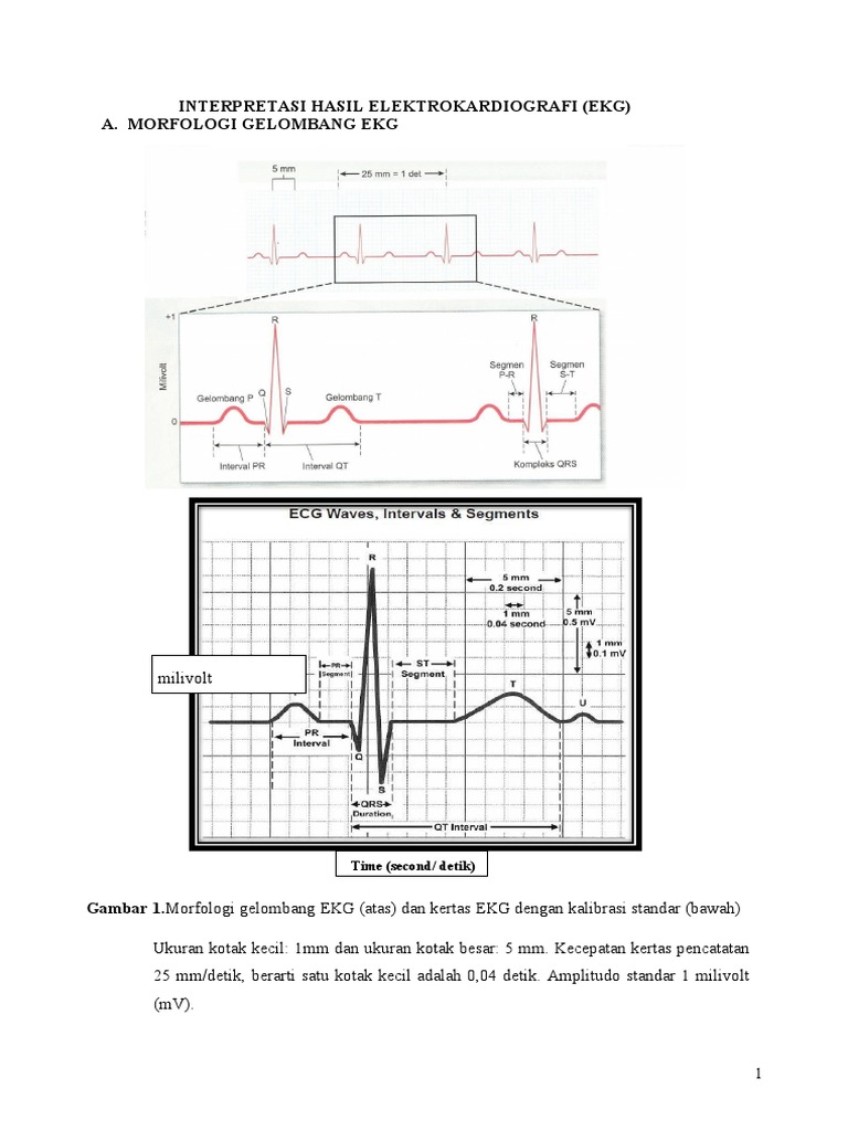 Interpretasi EKG | PDF
