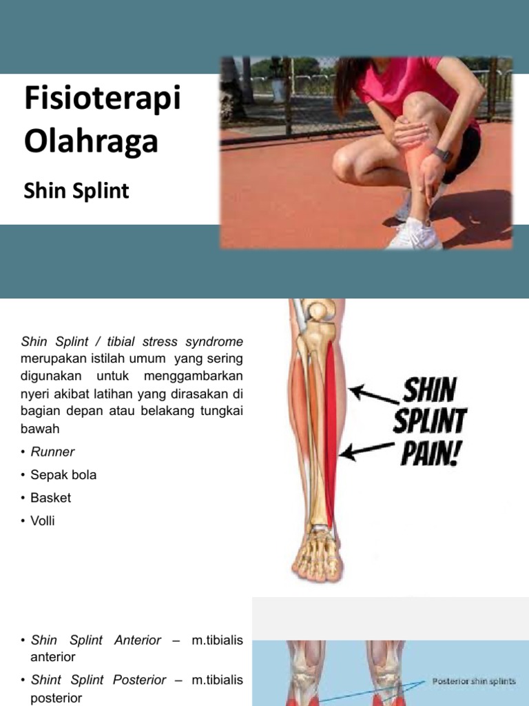 Shin Splint | PDF