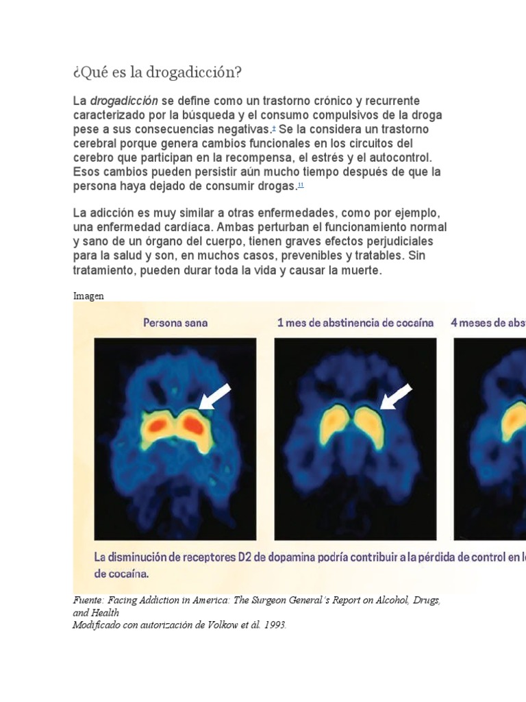Qué es la drogadicción | PDF | La dependencia de sustancias | Drogas
