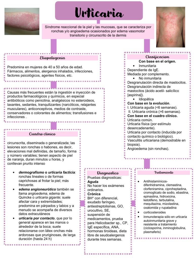 URTICARIA | PDF | Medicina CLINICA | Especialidades Medicas