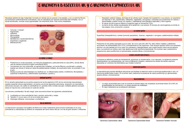 Carcinoma Basocelular y Espinocelular | PDF | Cáncer | Piel
