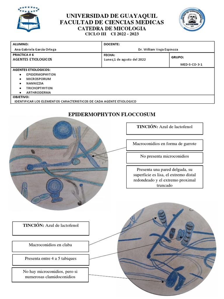 Practica O6 Agentes Etiologicos de Dermatofitosis Epidermophyton ...