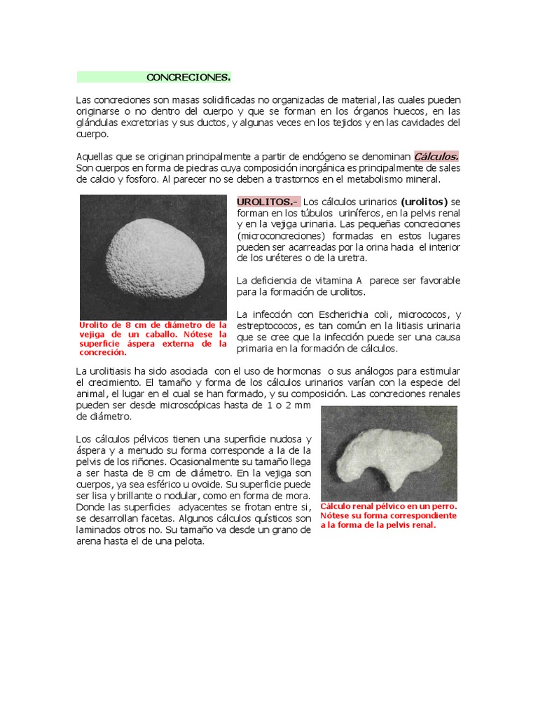 Concreciones | PDF | Vejiga urinaria | Riñón