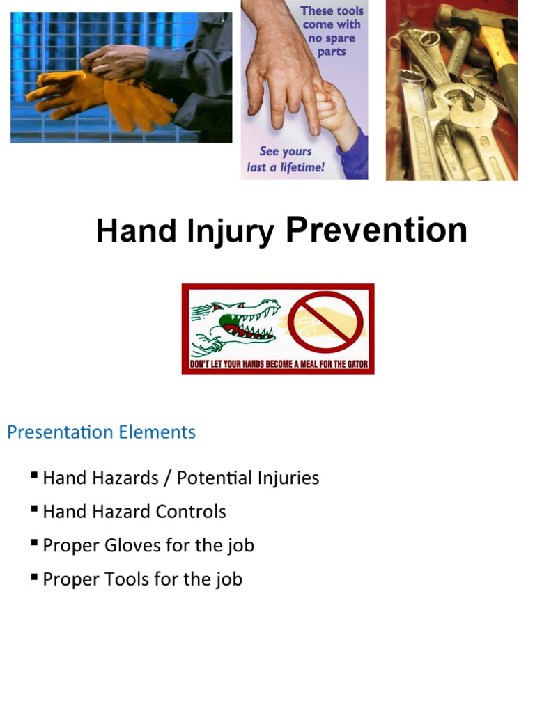 Hand Injury Prevention | Download Free PDF | Hand | Injury