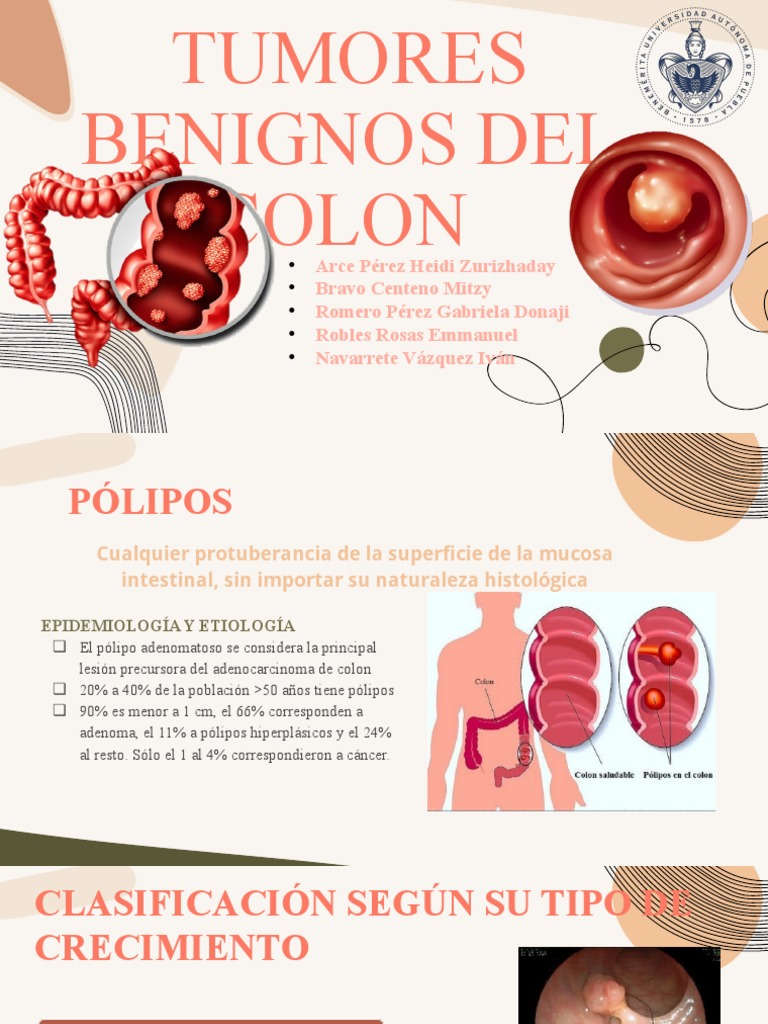 Expo de Tumores Benignos de Colon | PDF | Cáncer colonrectal | Medicina