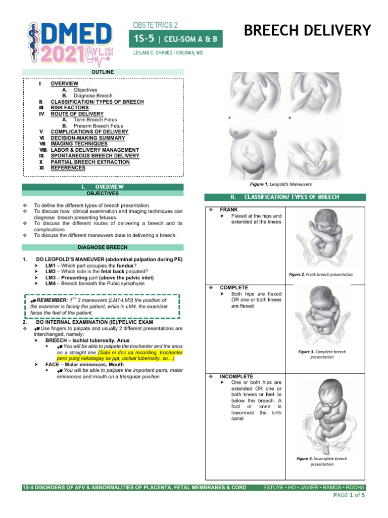 Breech Delivery | PDF | Childbirth | Fetus