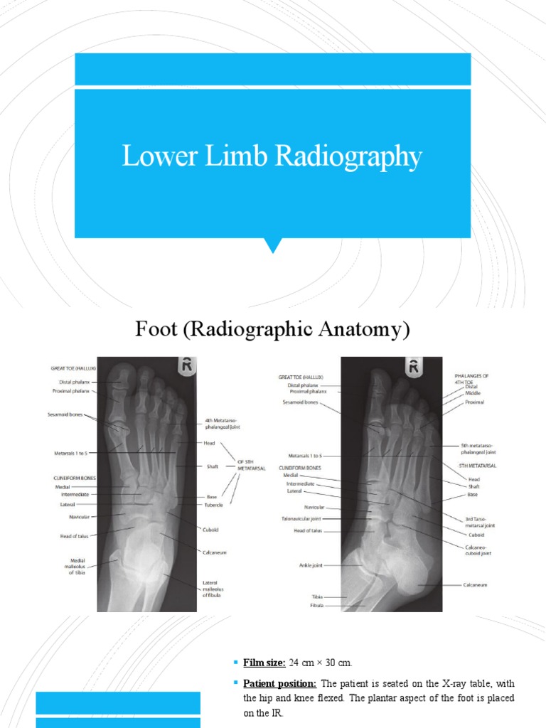 Lower Limb Radiography | PDF