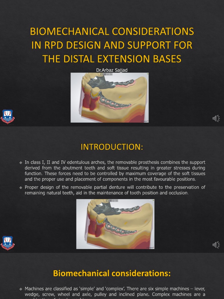 Biomechanical Considerations in RPD Design and Support For The Distal Extension Bases | PDF
