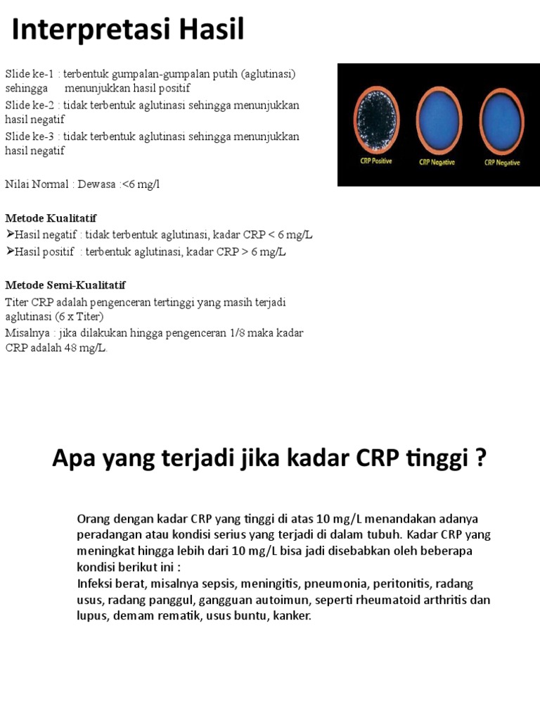 Interpretasi Hasil | PDF