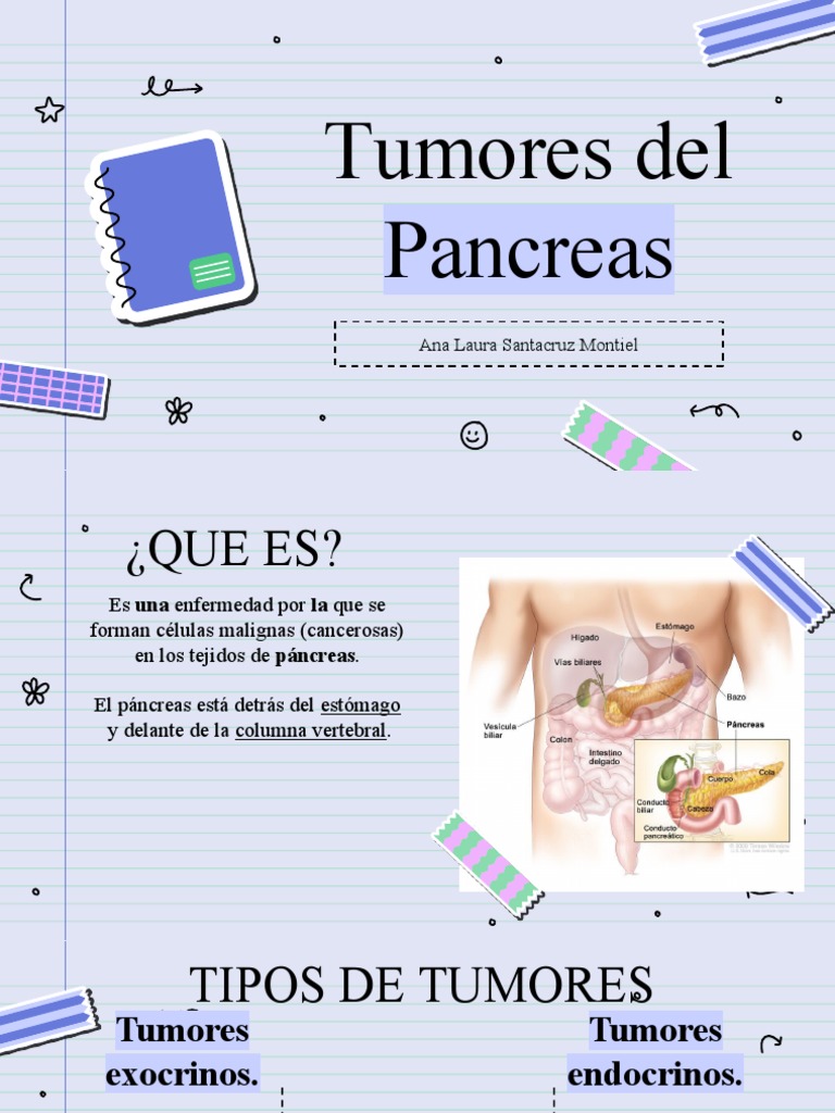 Tumores Del Pancreas | PDF | Cáncer | Páncreas