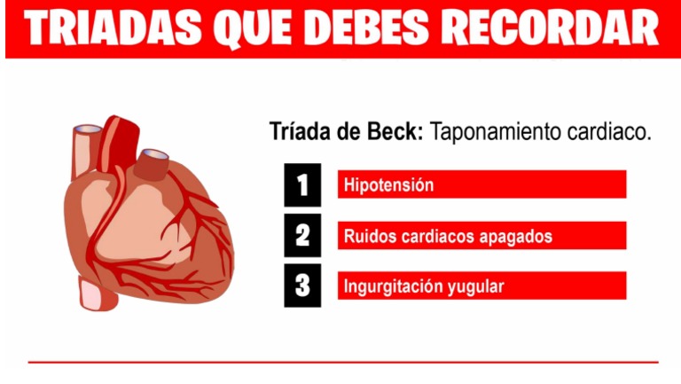 Triada de Beck | PDF