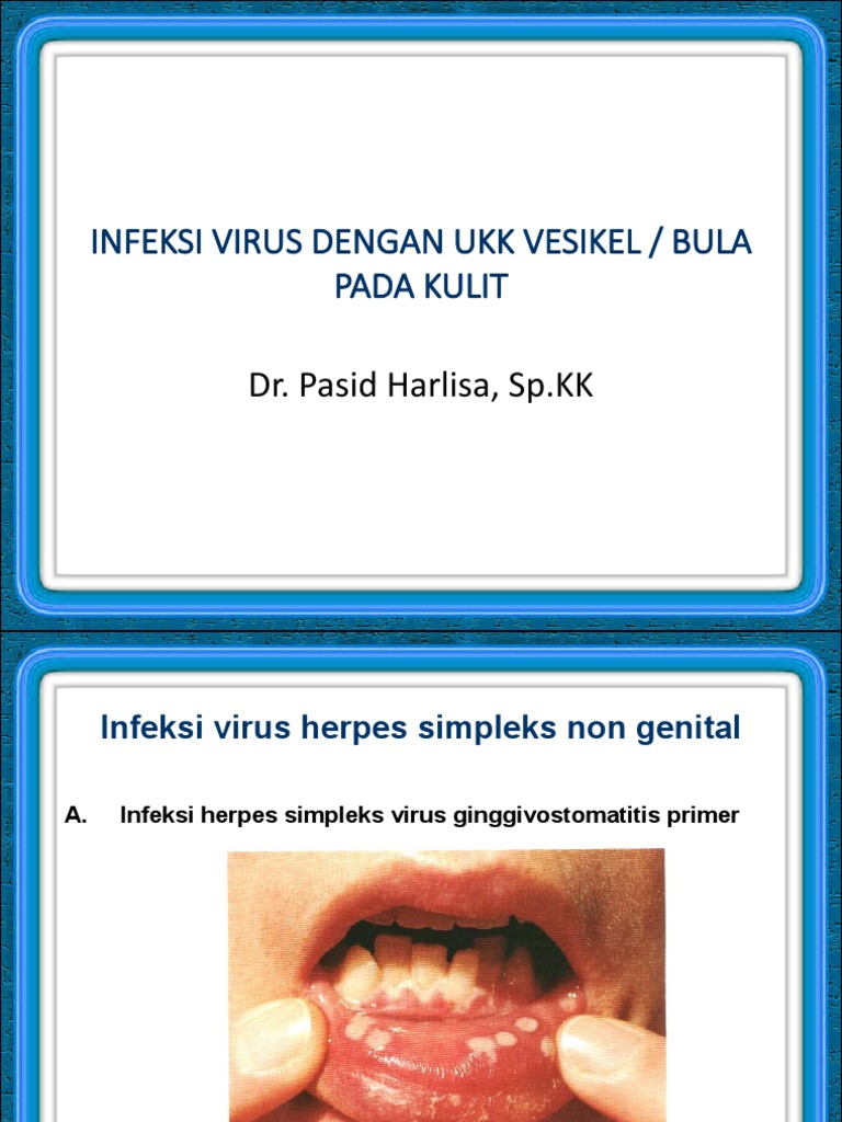 1.2 Ukk Infeksi-Virus-Dengan-Ukk-Vesikel | PDF