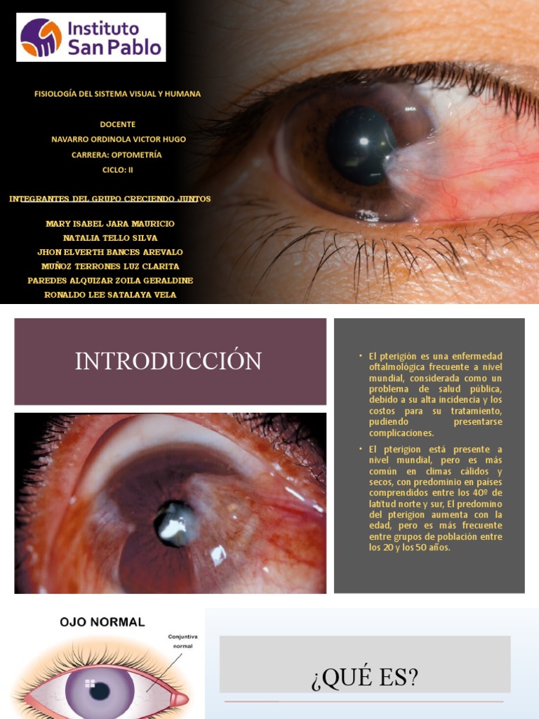 Carnocidad 222 | PDF | Ojo humano | Ojo