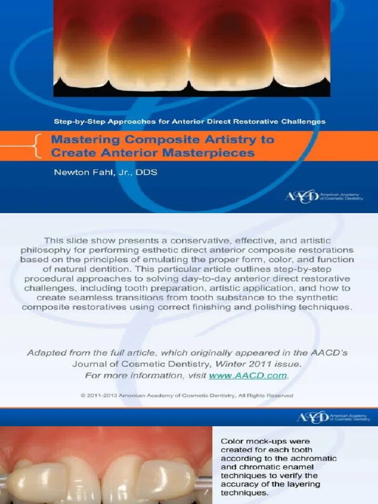 Anterior Composite Restoration | PDF