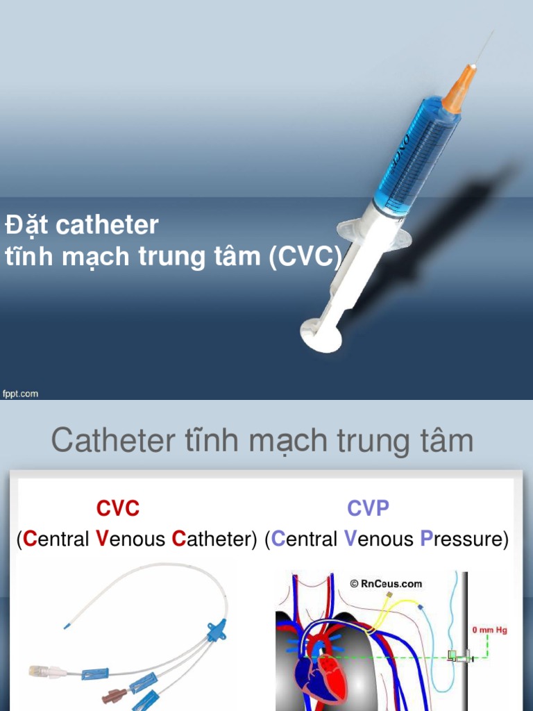 Hướng Dẫn Kỹ Thuật Đặt CVC - No Name | PDF