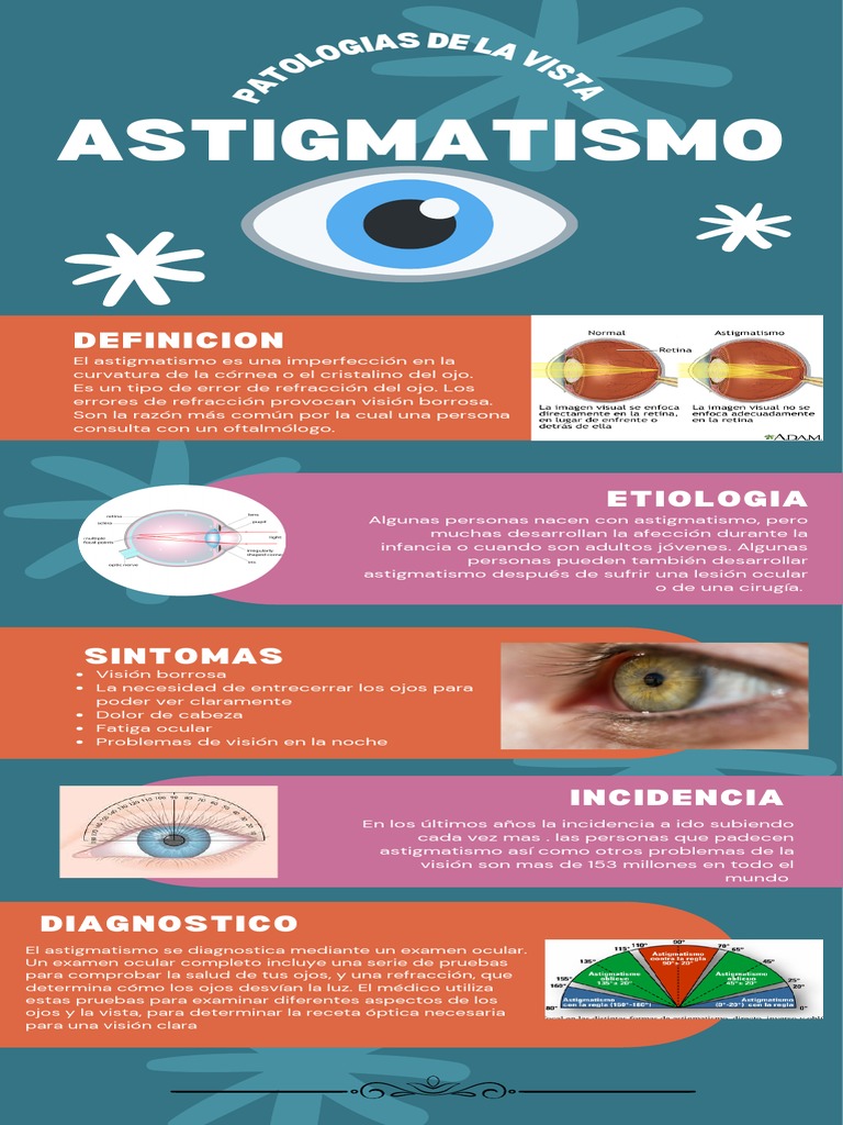 Astigmatismo: Diagnóstico y Tratamiento | PDF | Ojo humano | Percepción ...