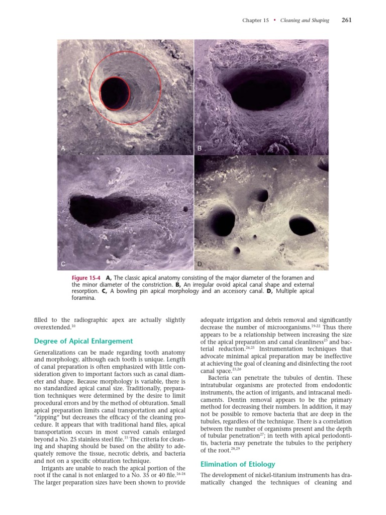 Endodontics Principles and Practice (280 429) | PDF