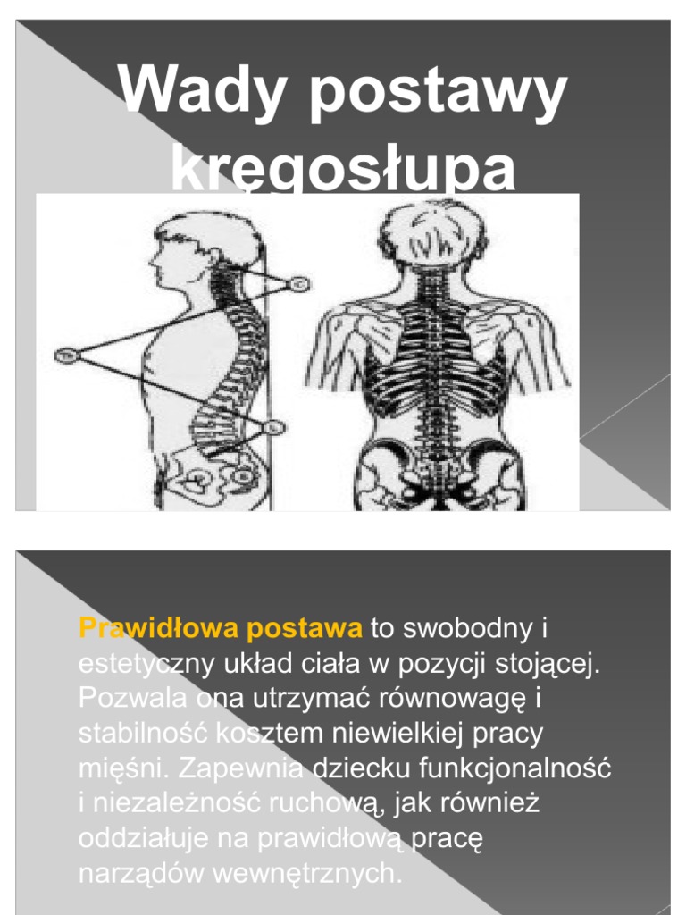 Wady Postawy Kregoslupa | PDF