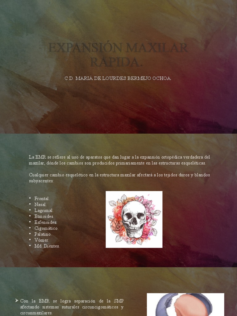Expansión Rápida del Maxilar en Ortodoncia | PDF | Cara | Cabeza y ...
