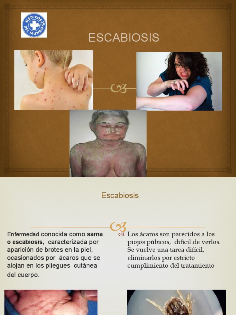 Laminas DeLa Escabiosis | PDF | Piel | Especialidades Medicas