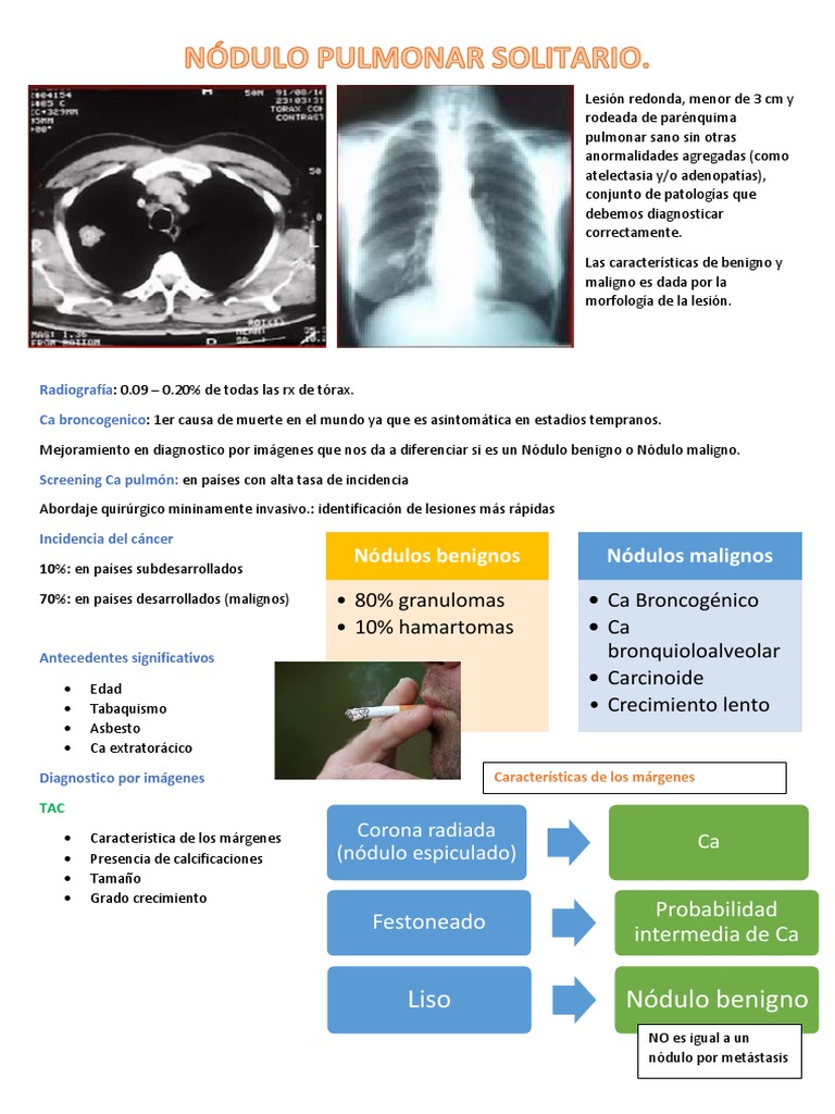 Nódulo Pulmonar Solitario | PDF | Cáncer de pulmón | Cáncer