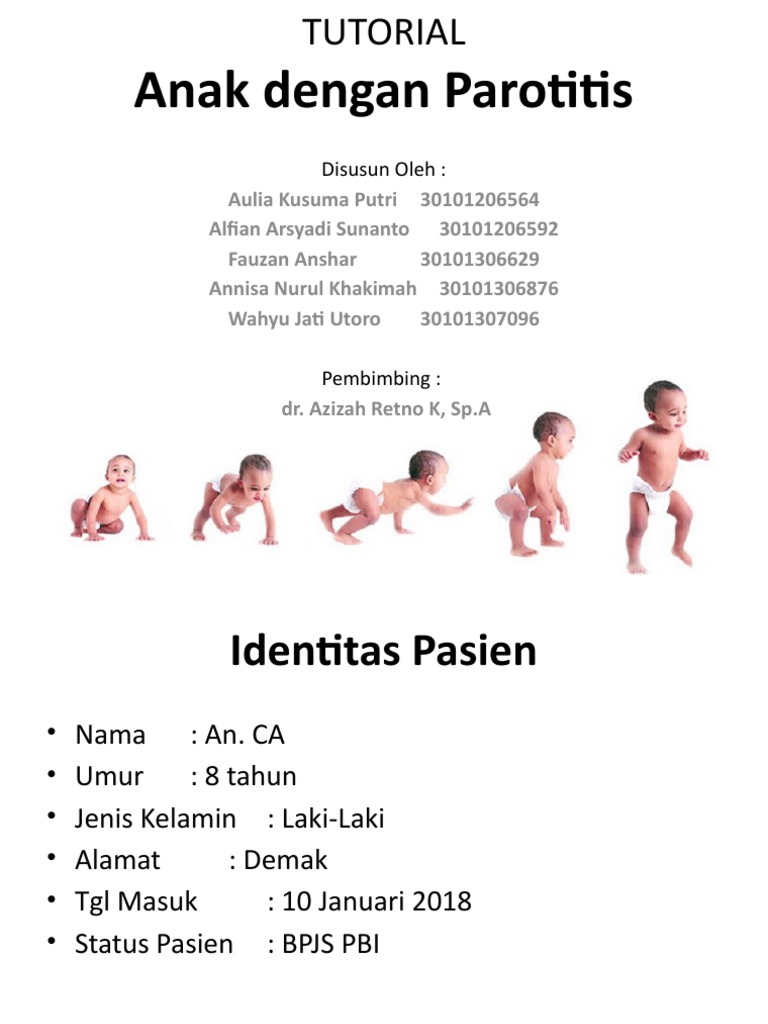 Refkas Parotitis | PDF