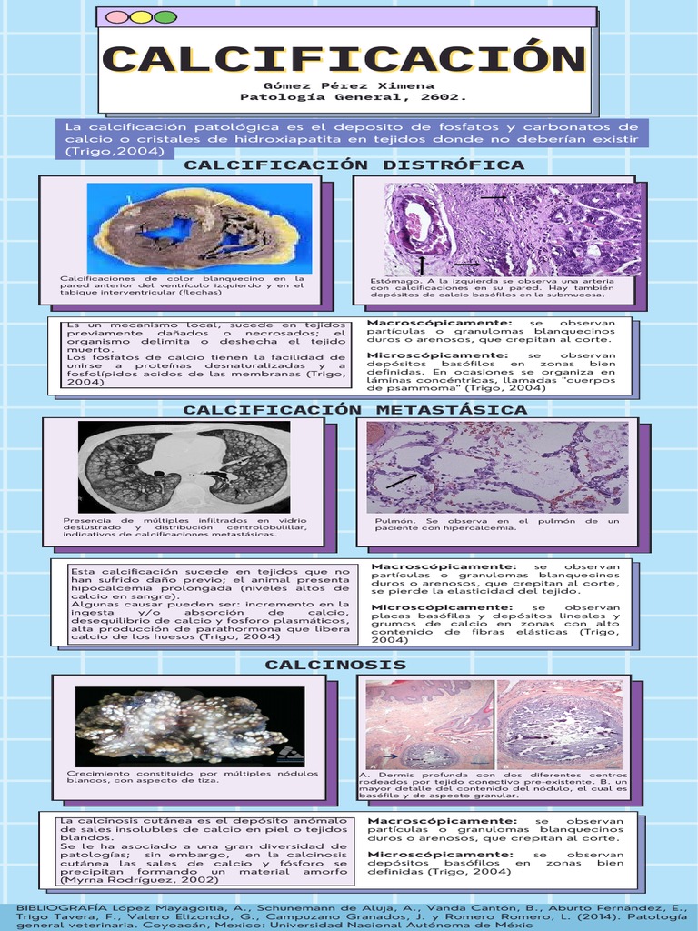 Calcificación | PDF | Calcio | Medicina CLINICA