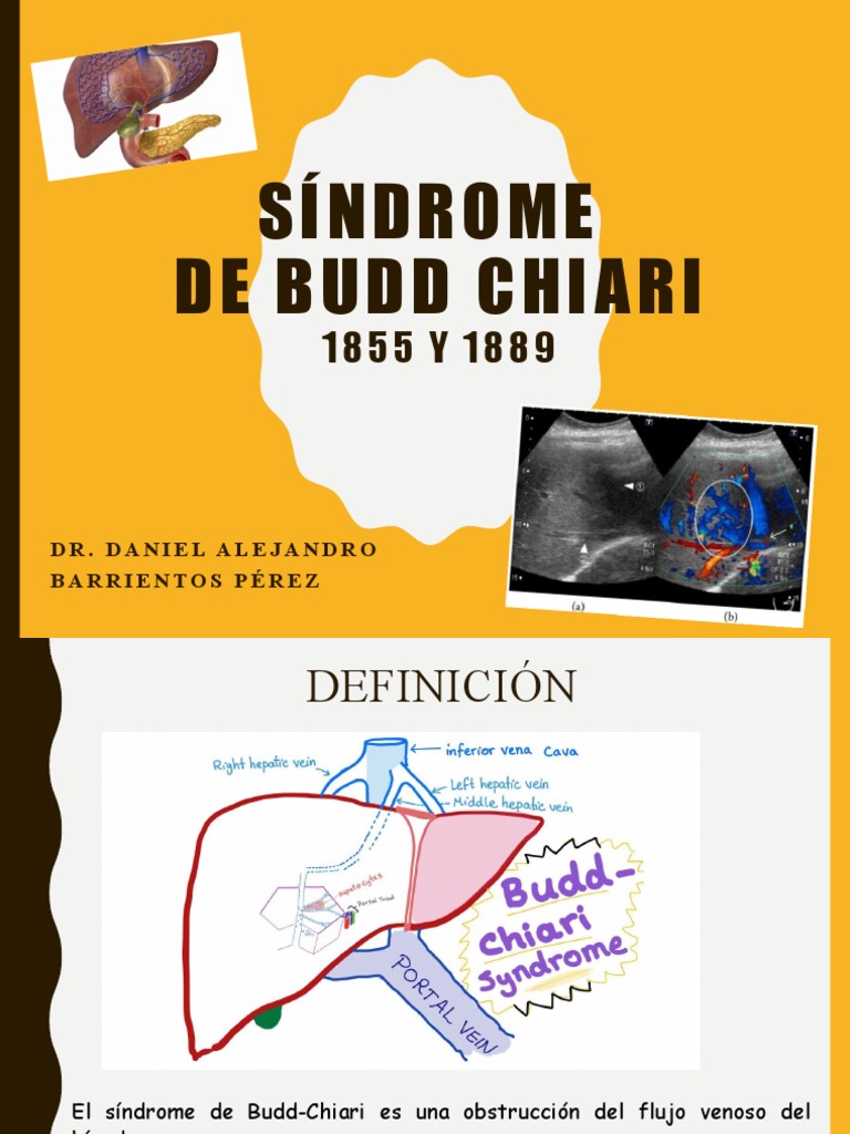 SX Budd Chiari Power | PDF | Cirrosis | Medicina