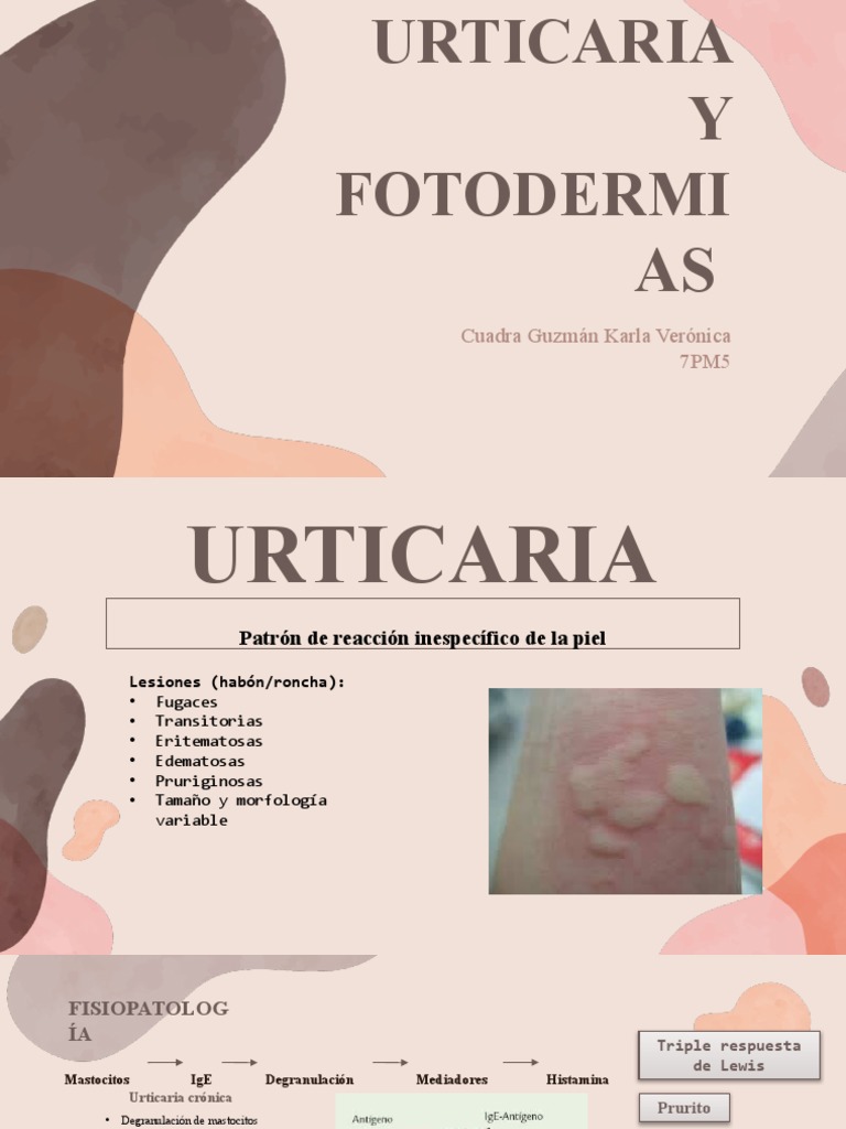 Urticaria y Fotodermias | PDF | Condiciones cutáneas | Epidemiología