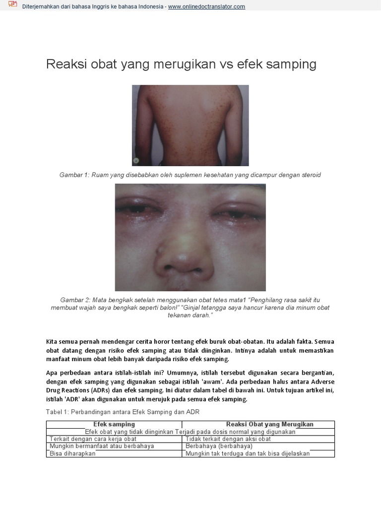 Adverse Drug Reactions Vs Side Effects - En.id | PDF