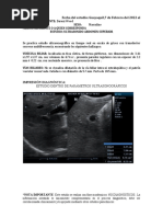 Quiste de Inclusion Epidermica | PDF | Piel | Ultrasonido médico